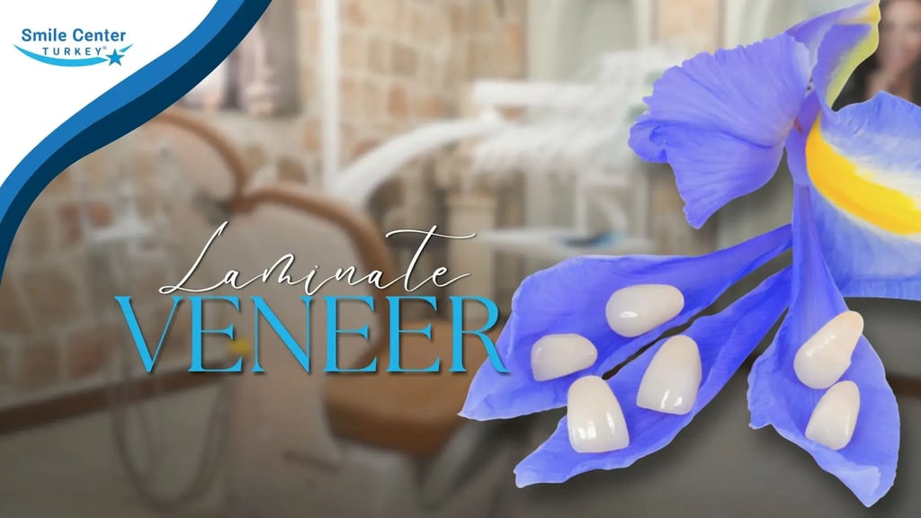 Laminate Veneers Turkey | Smile Center Turkey