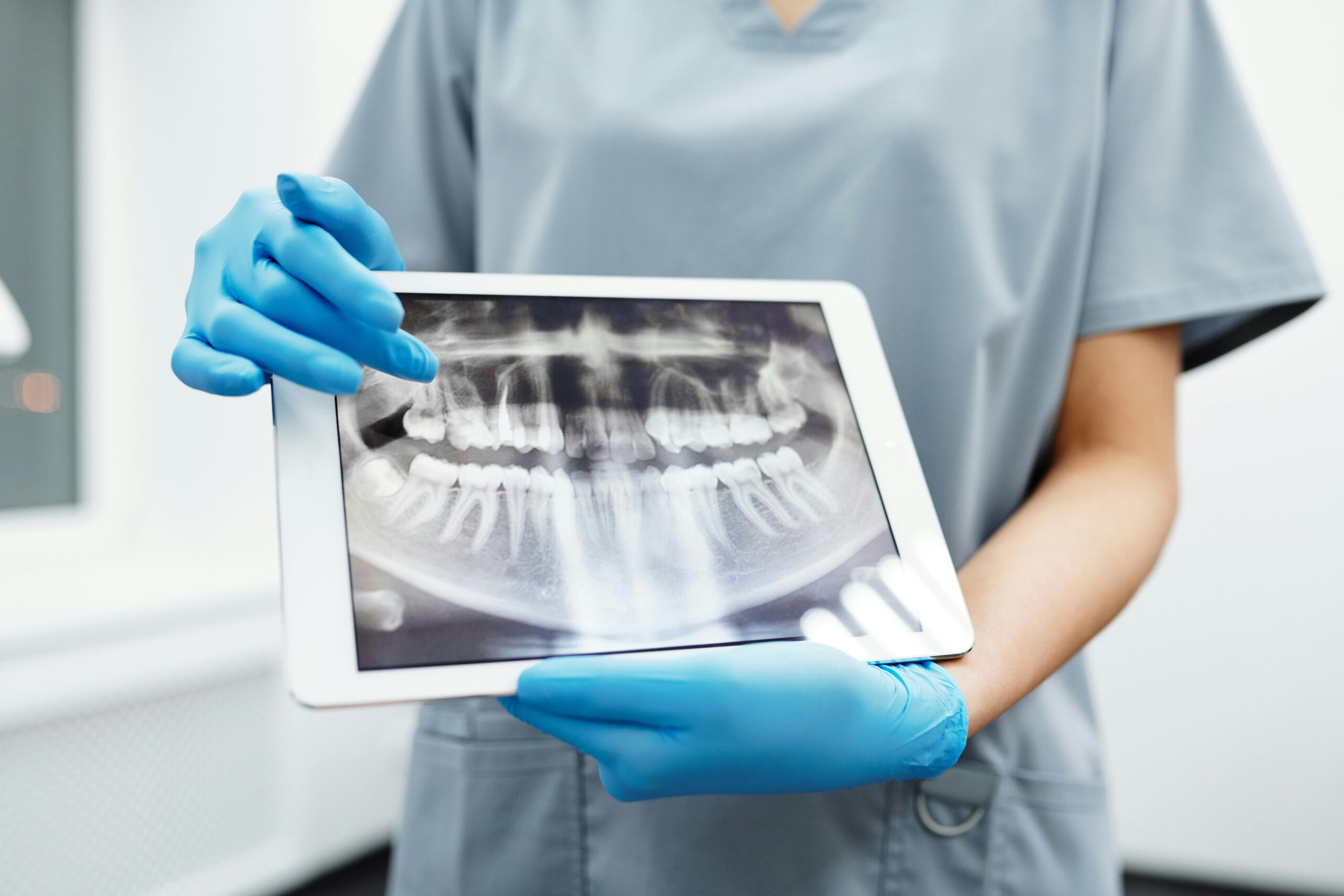 Comprehensive Guide to Root Canal Failure | Smile Center