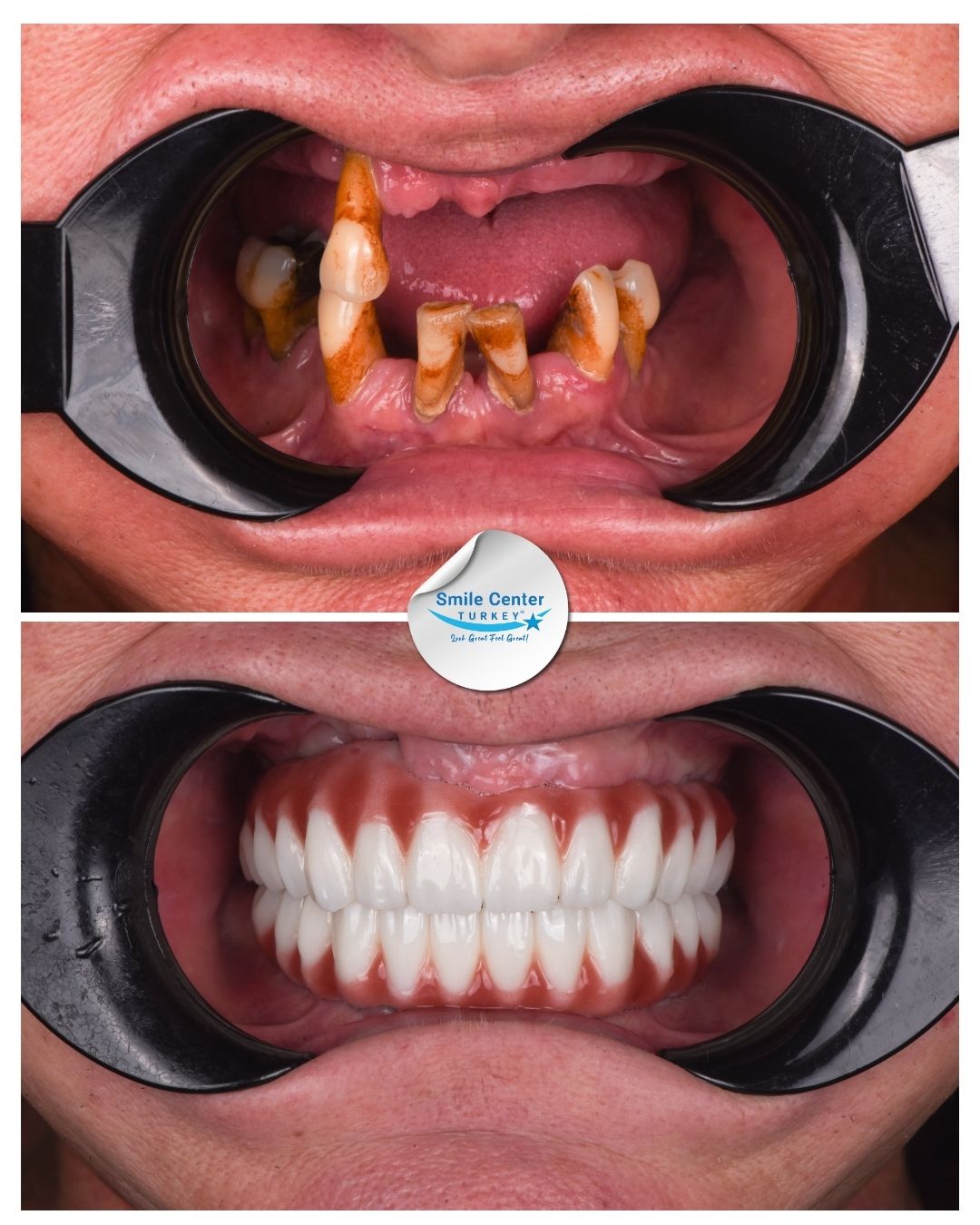 Debbie D. - Smile Center Turkey®