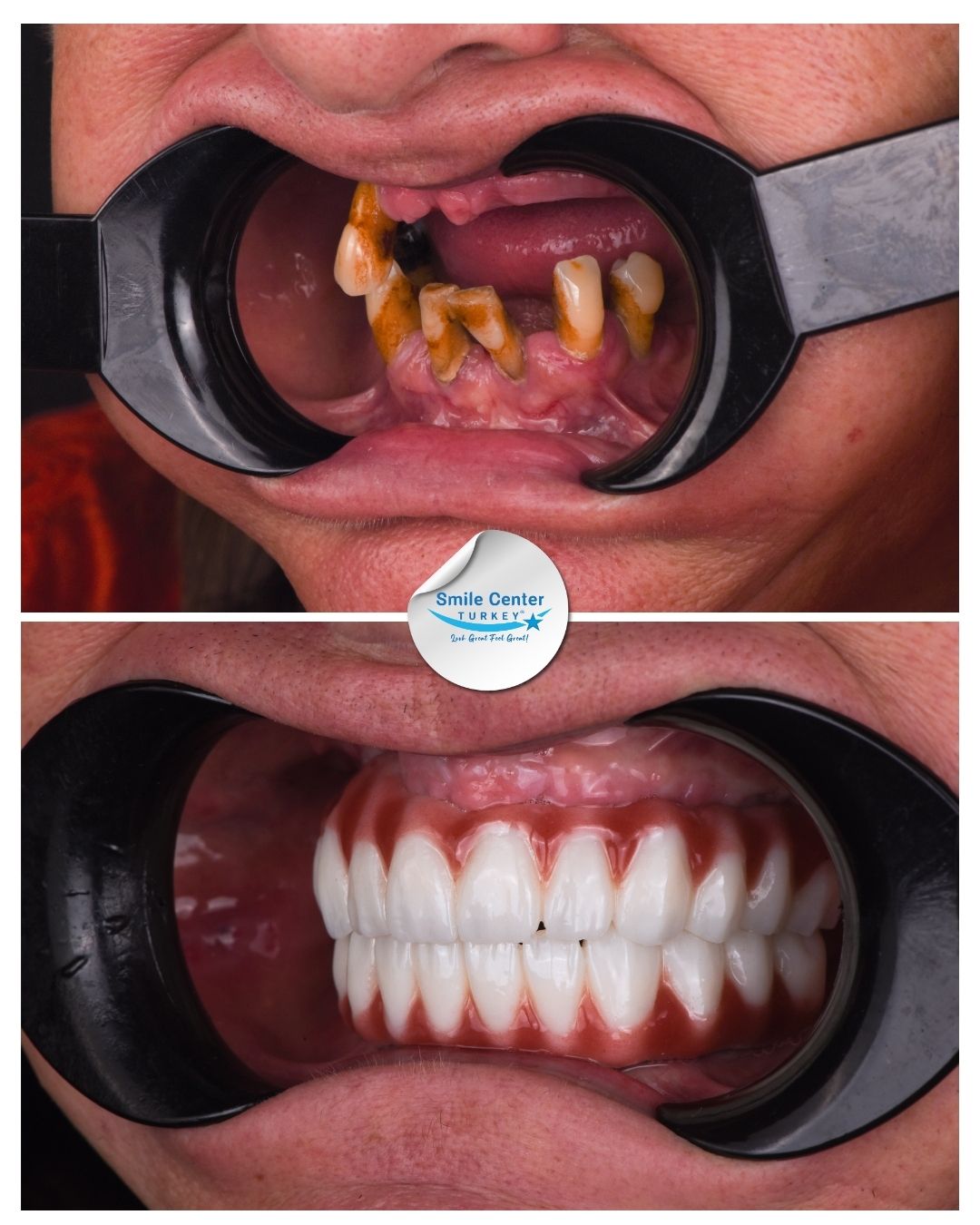 Debbie D. - Smile Center Turkey®